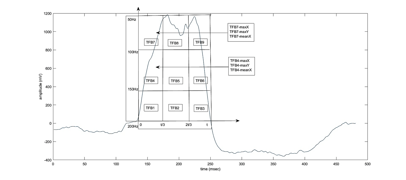 Qrs Complex Wavelet Analysis Can Distinguish Patients With And Without
