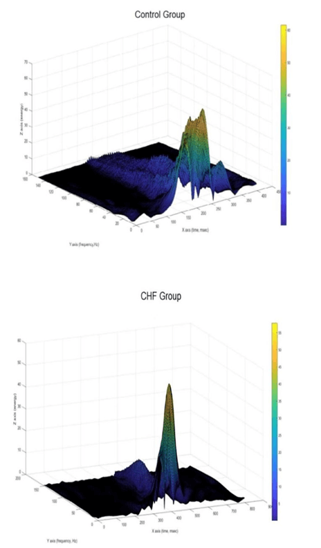 Qrs Complex Wavelet Analysis Can Distinguish Patients With And Without