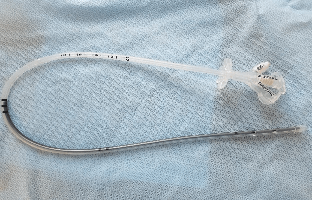 A Novel Approach to Managing Giant Duodenal Ulcer Perforations ...