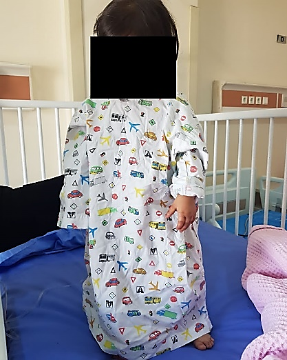 Airway Challenges in Sanjad-Sakati Syndrome (SSS): A Case Report and ...