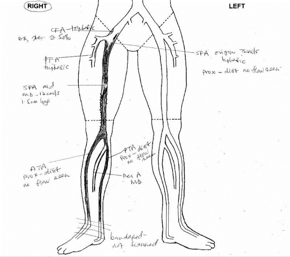Peripheral Vascular Femoral Procedures Lower Extremity Limb Arteries